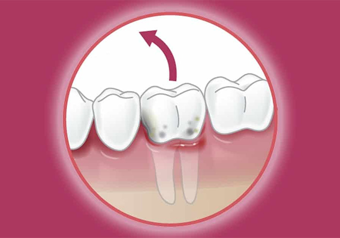 General Dentistry | Pier Dental