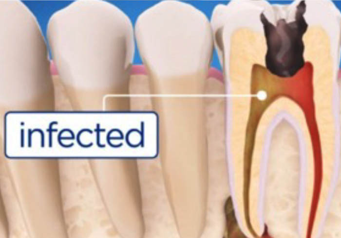 General Dentistry | Pier Dental