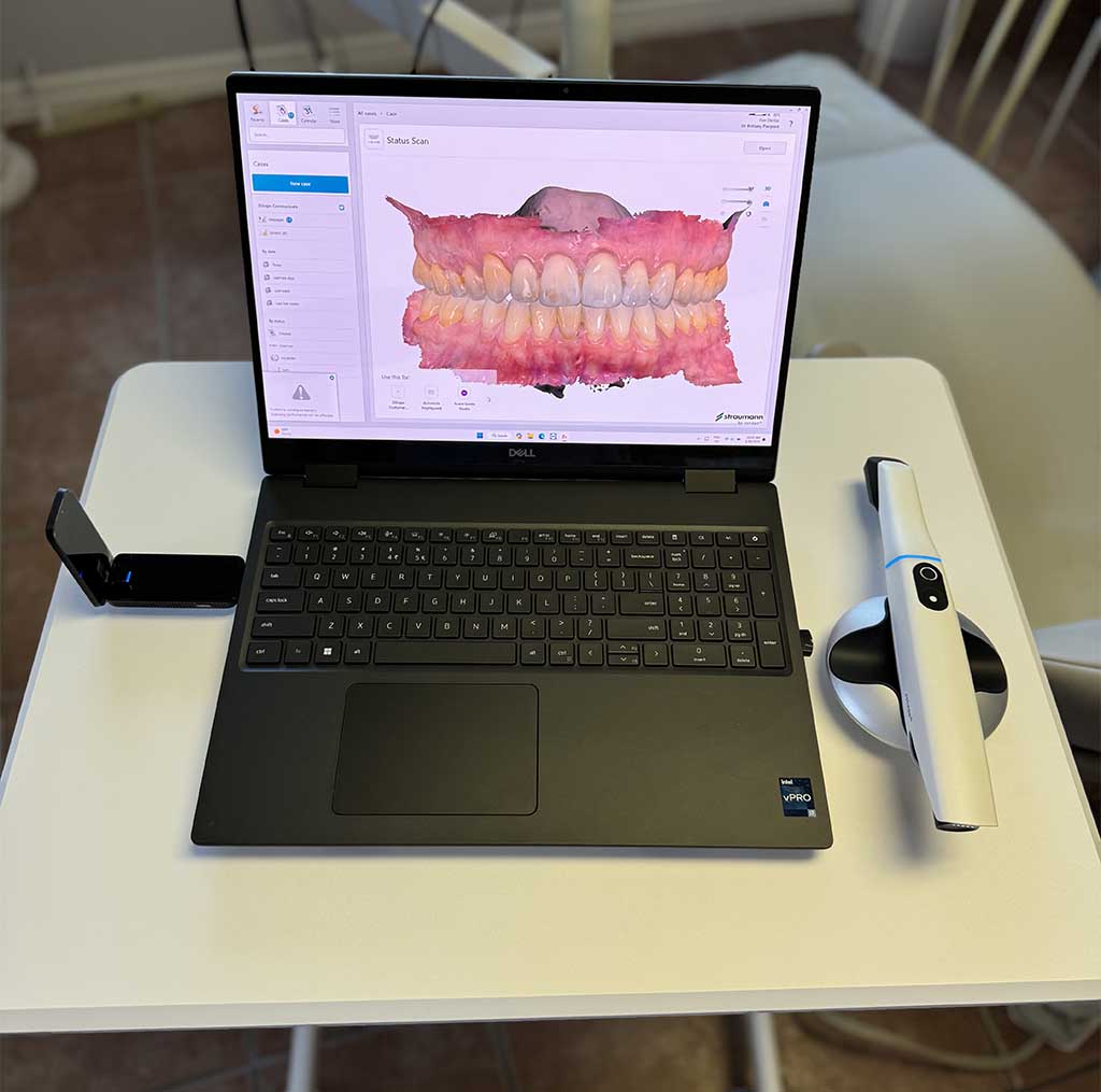 TRIOS® Intraoral Scanner | Pier Dental